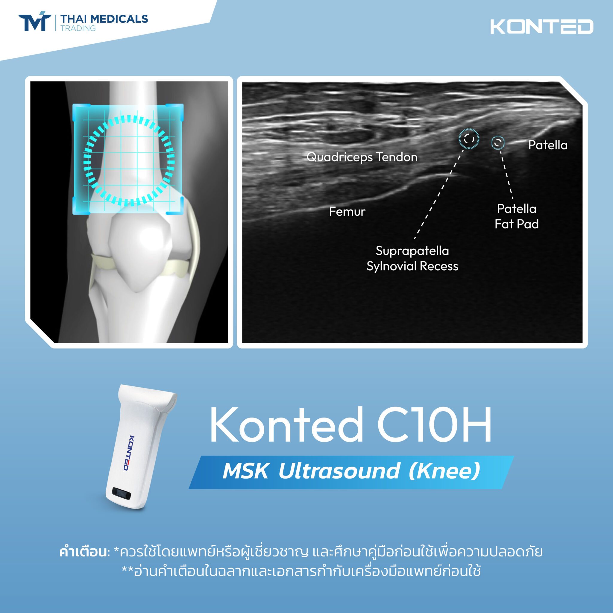 Wireless Ultrasound Konted C10H - thaimedicaltrading